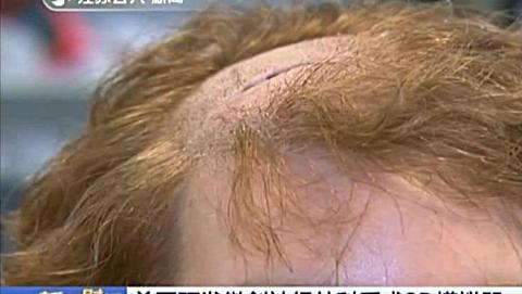 美国研发出微创神经外科手术3D模拟器, 逼真到无法想象的地步!