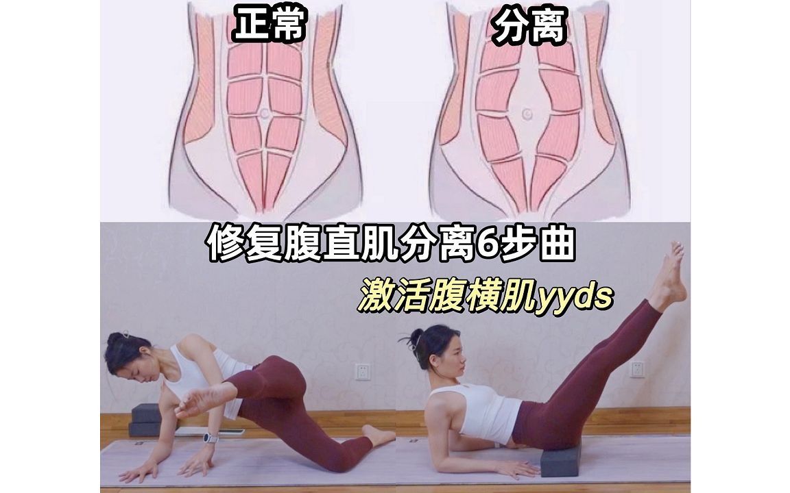 修复腹直肌分离6部曲,激活腹横肌