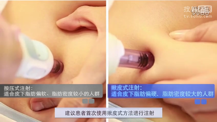 快舒尔胰岛素QS-M型无针注射器标准注射流程_高清