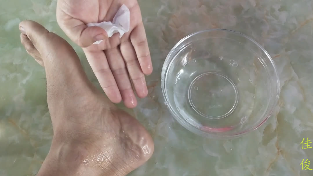 去死皮原来一点都不难,只需要这两样,在家就可以做到