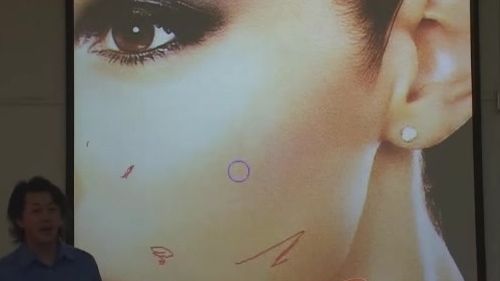 PS学习之修饰工具的灵活使用,如何一键祛除污点?看完受益匪浅