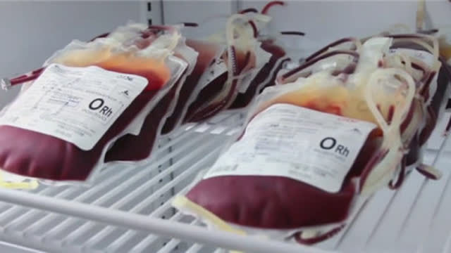 熊猫血原来并不是最稀有的血型,这种更加珍贵,全球仅有43人拥有!