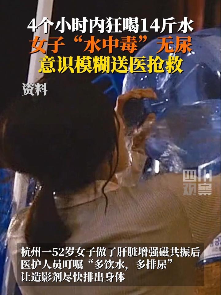 ...抢救,医生提醒:短时间摄入大量水,可能导致肺水肿、脑水肿,甚至死亡。