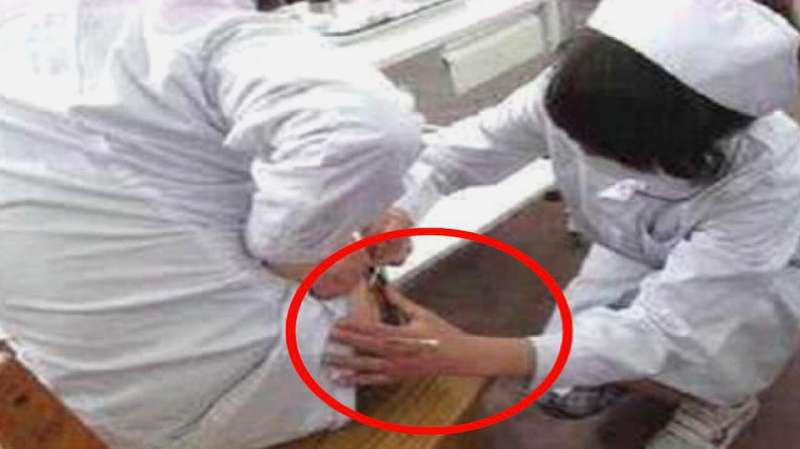 为何打针时总爱打在屁股上,其他部位不可以吗?医生做出解释!