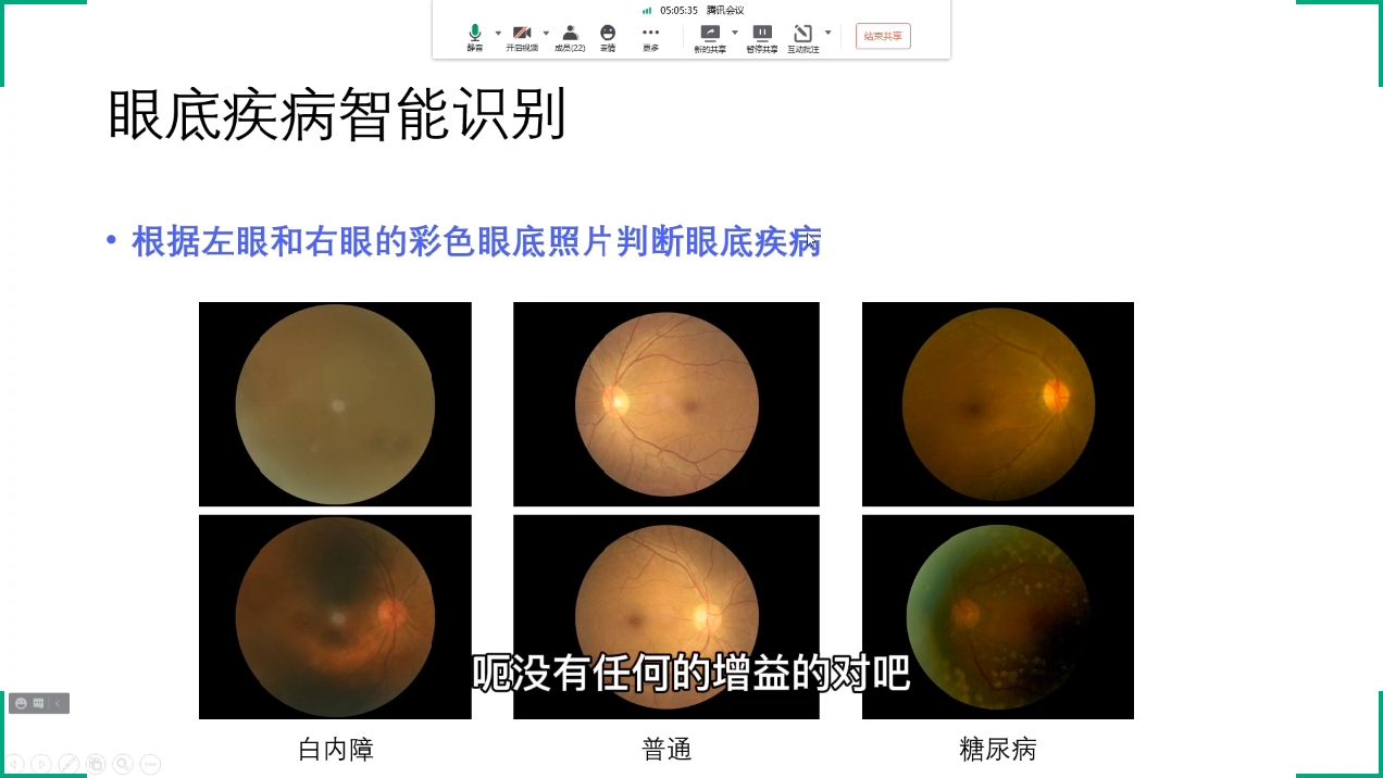 一站式影像组学工具实现病灶识别的具体科研流程#医学影像组学