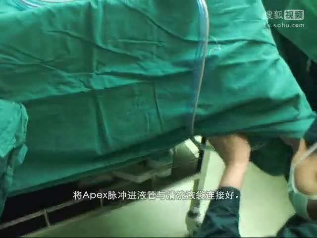 一次性脉冲冲洗器操作方法