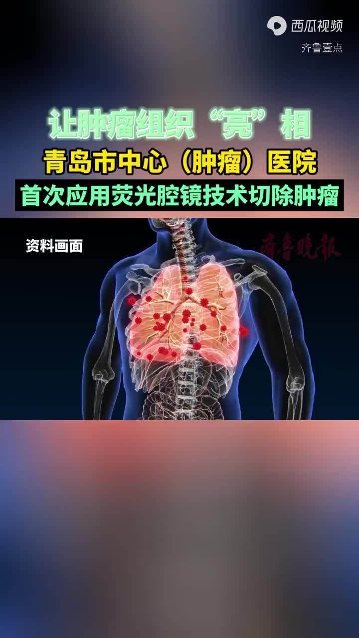 让肿瘤组织"亮"相!这家医院首次运用荧光腔镜技术切除肿瘤