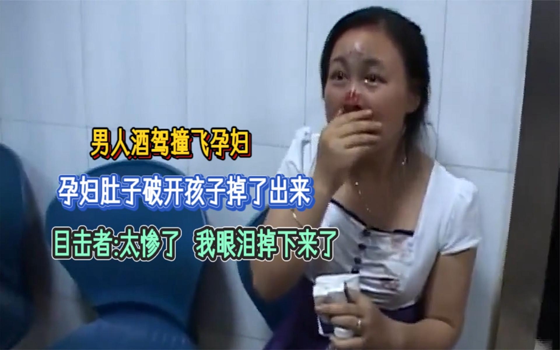 男人酒驾撞飞孕妇,孕妇肚子破开孩子掉了出来,目击者:太惨了!