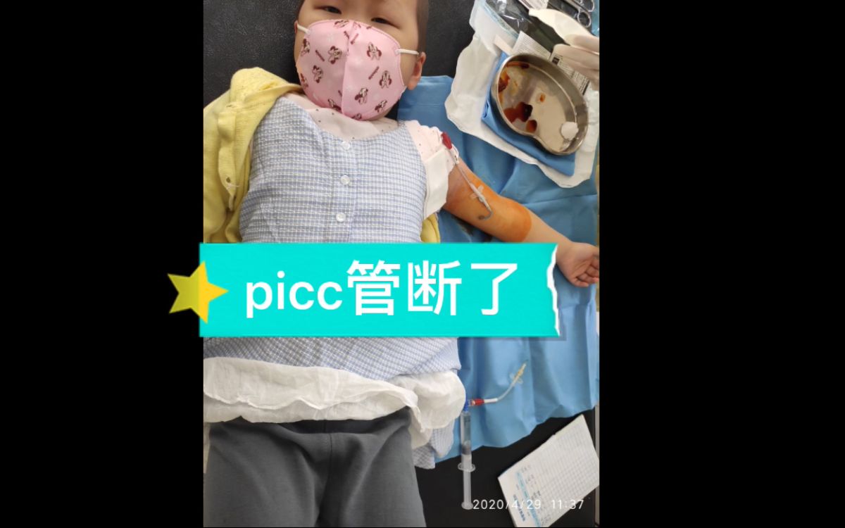 这根承载着我无数化疗药的PICC管居然断了