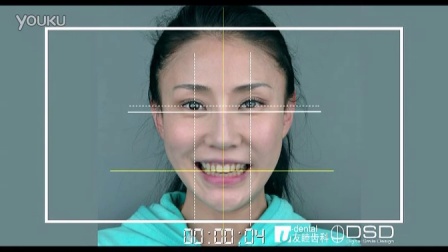 友睦齿科-DSD数码微笑设计
