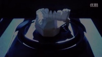 Open technologies Dental scanner牙科扫描仪