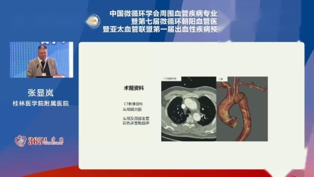   张显岚:TEVAR术中拓展应用单分支型支架重建弓上分支血管-单中心...