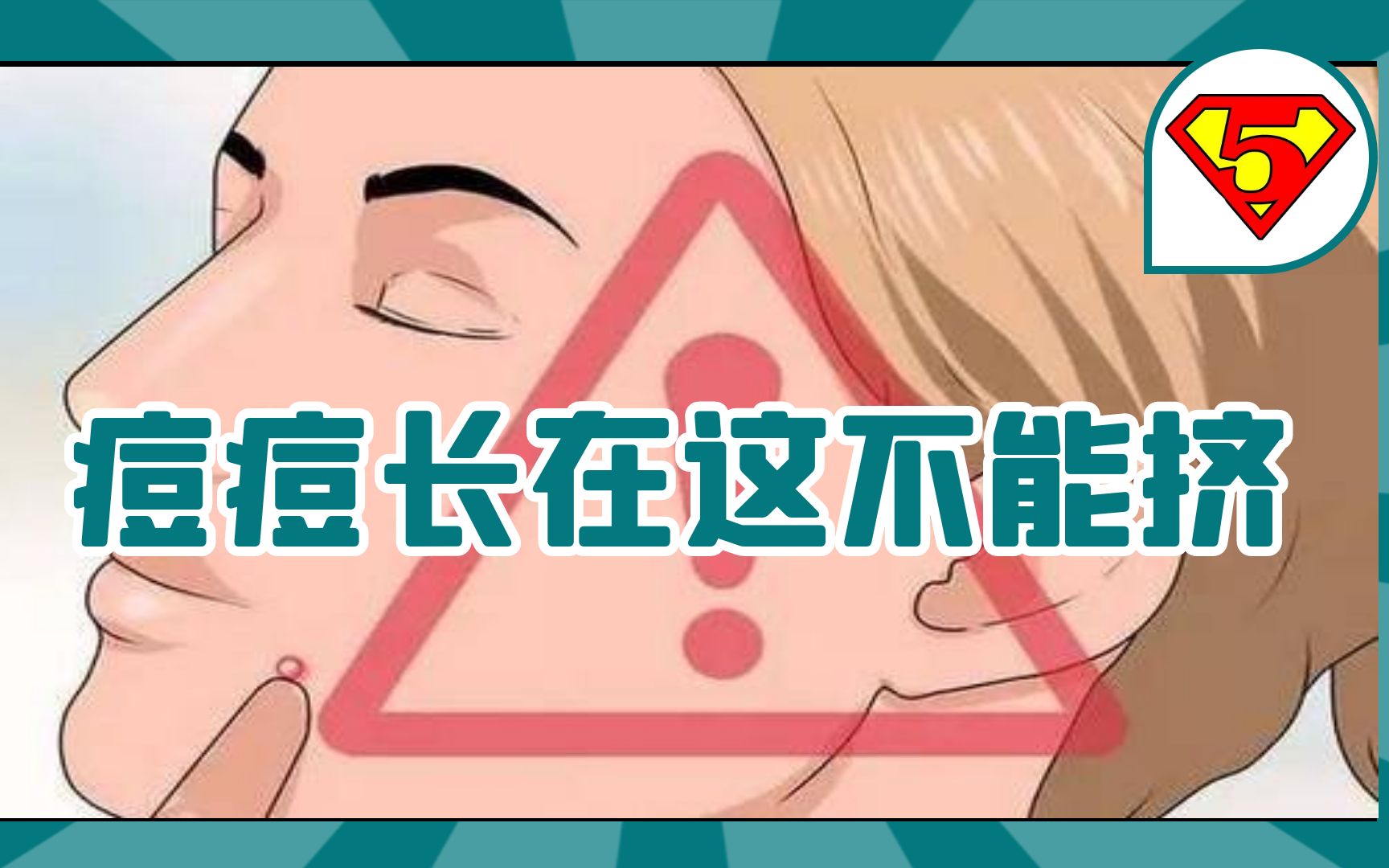 19岁少女挤痘引发颅内感染,再次强调,面部这个区域内的痘不能挤
