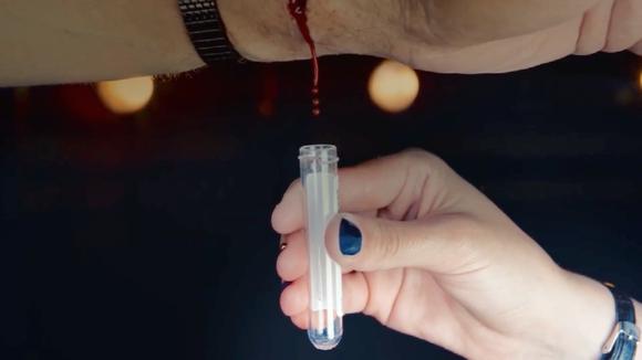 德古拉:医生想取吸血鬼的血,针却扎不进皮肤,吸血鬼亲自竟帮忙