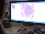 瑞典林雪平大学医院-高通量全数字化切片扫描应用