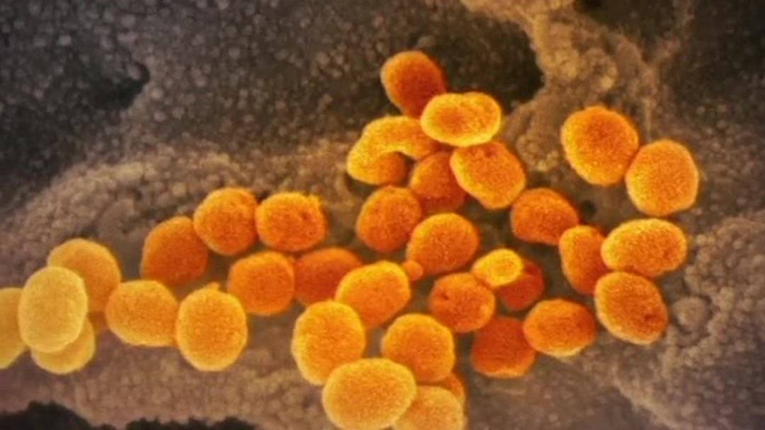 新冠病毒长什么样?新冠病毒在电子显微镜下图像被公布