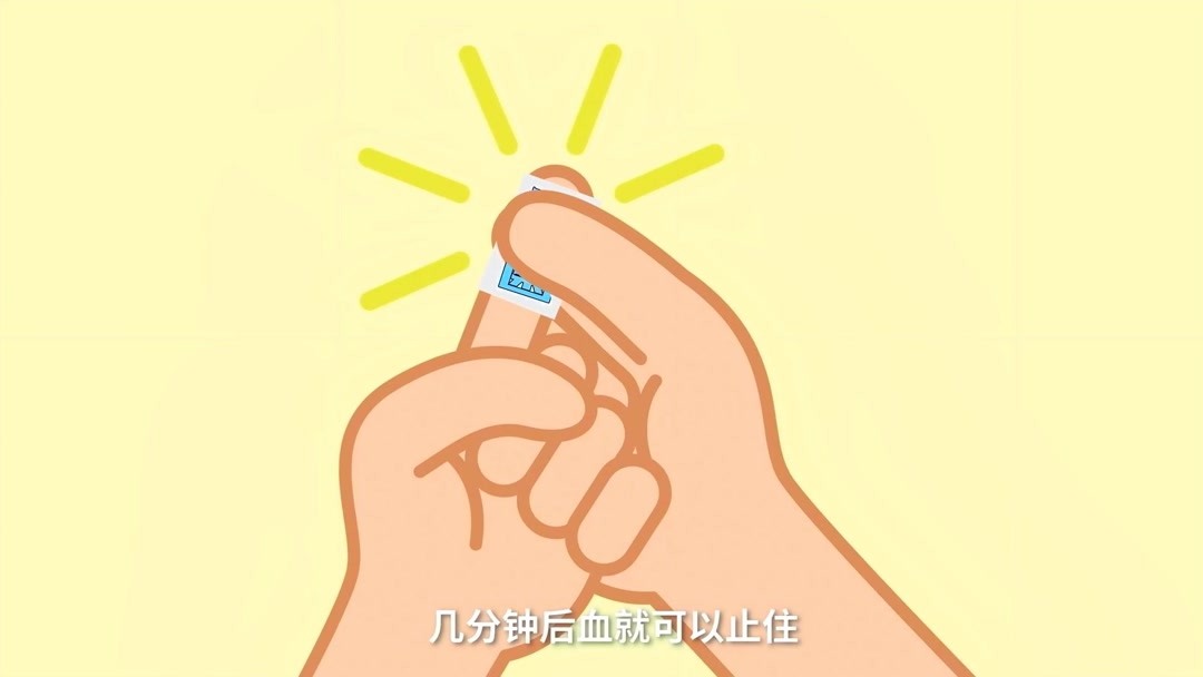 手指出血?教你一招紧急止血!