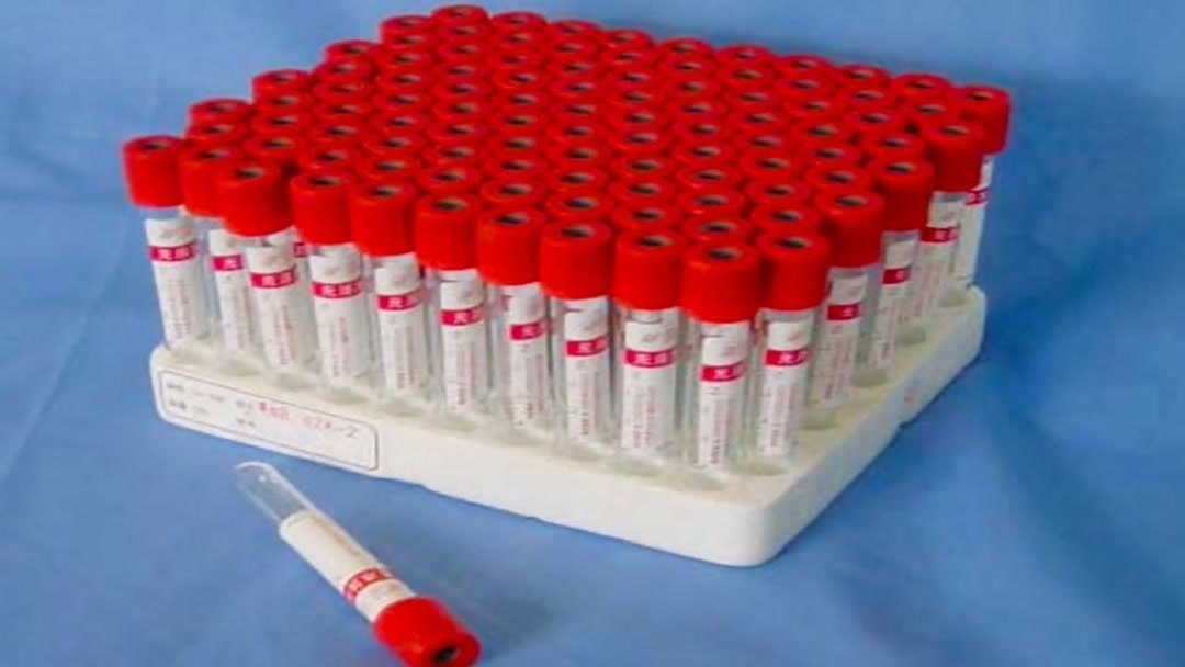 医疗器械行业:在采血试管装盘机中,如何把试管跟料盘组合