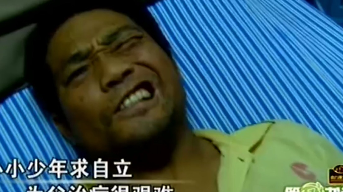 第一书记:看着父亲被病痛折磨,生命进入倒计时,儿子崩溃落泪!