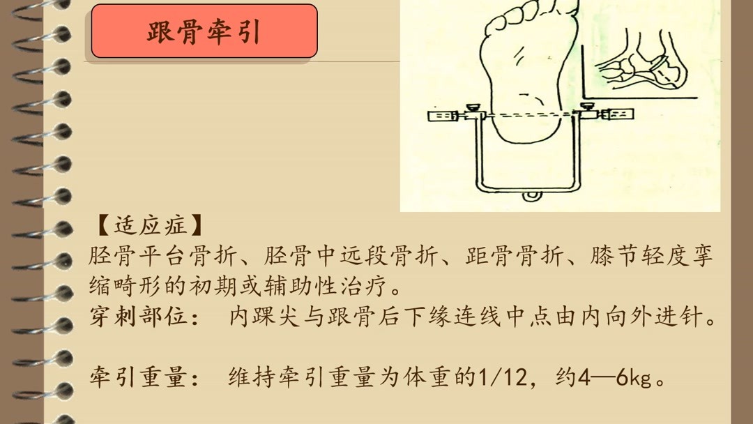 骨科牵引术PPT