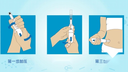 三步操作完成胰岛素的注射无针注射器新体验