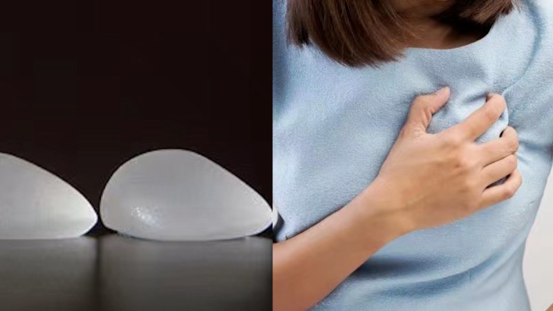 女子花3万元做假体隆胸材料被掉包,法院:医疗机构退还手术费,并赔9万元