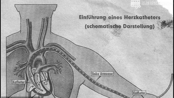 最惊悚的自体实验,他将导管插入自己心脏里