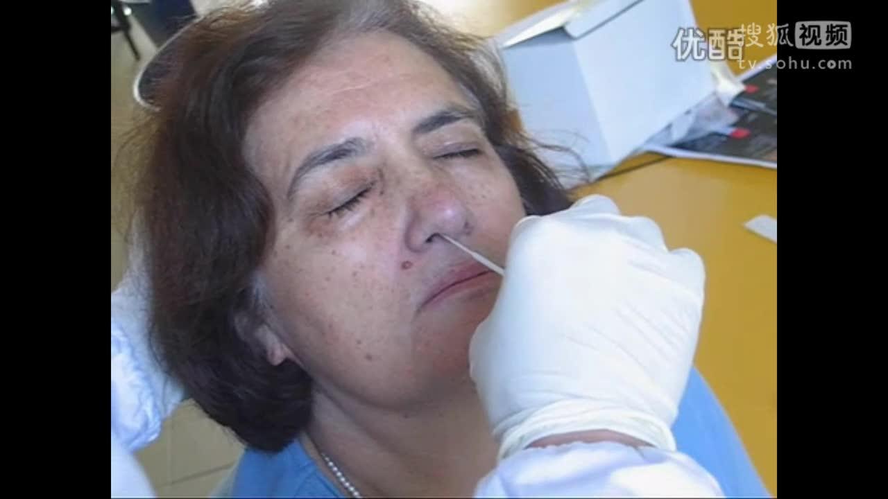 一次性杀菌鼻腔采样拭子鼻腔植绒采样拭子