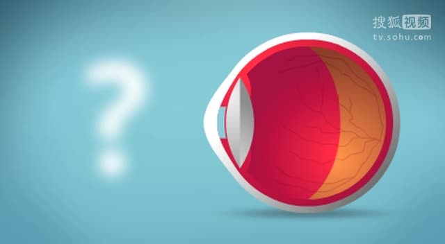 是什么导致视觉模糊?