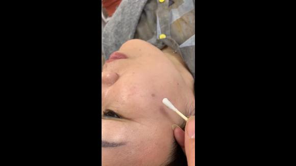 推荐几款可以淡斑的食品