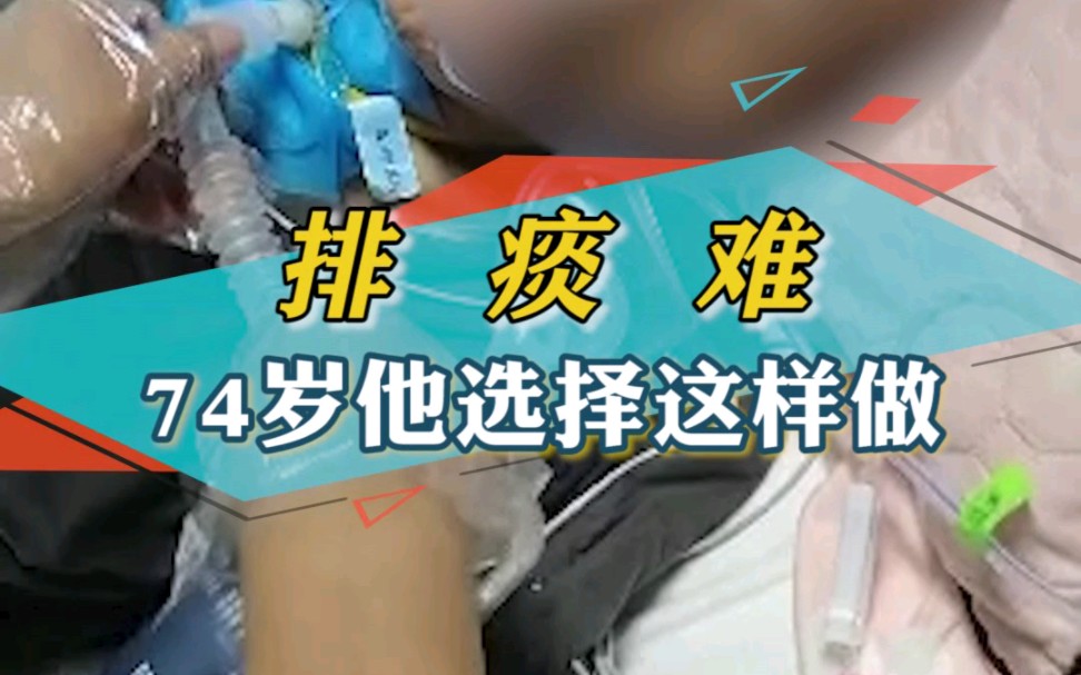 74岁老人排痰成难题,在工程师的帮助下纠正错误护理手法,帮助老人...