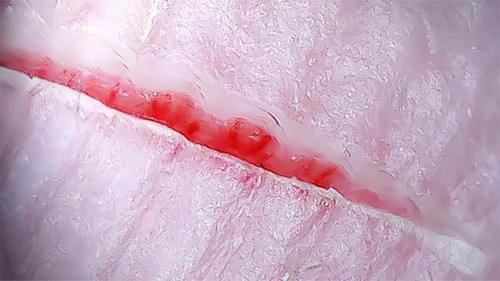 人体受伤后伤口是如何愈合的?动画模仿全过程,场面一目了然