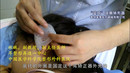 “益耳”耳廓矫形器使用方法
