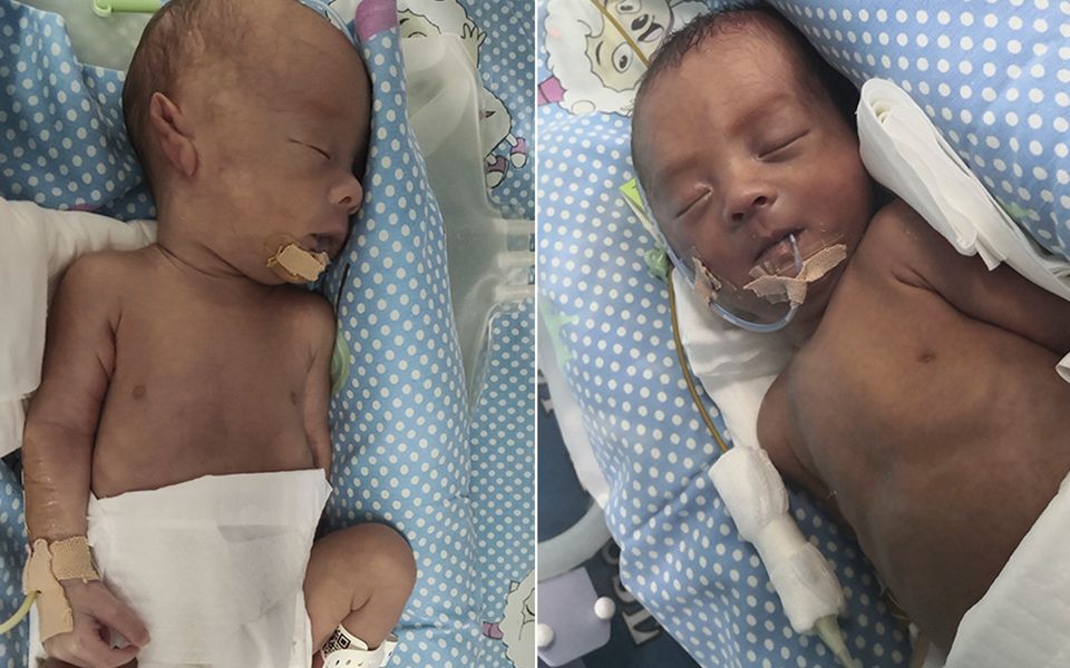 二婚夫妻通过试管手术艰难求子,喜得双胞胎,孩子一出生悲剧了