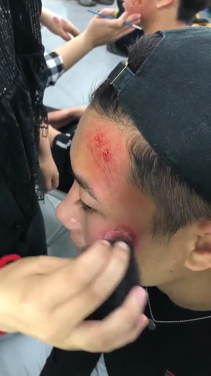 受伤了!擦伤!非常简单!易学!你学会了吗?