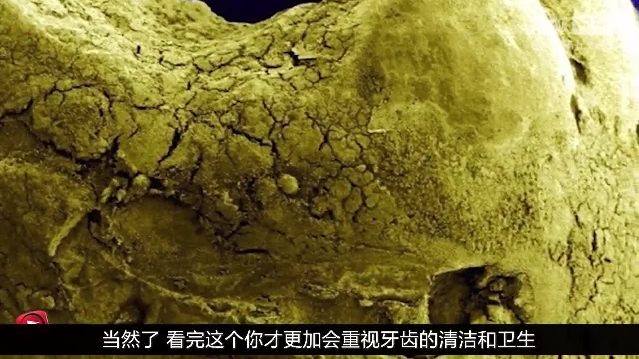 在显微镜下看这些东西,你能认得出几个?