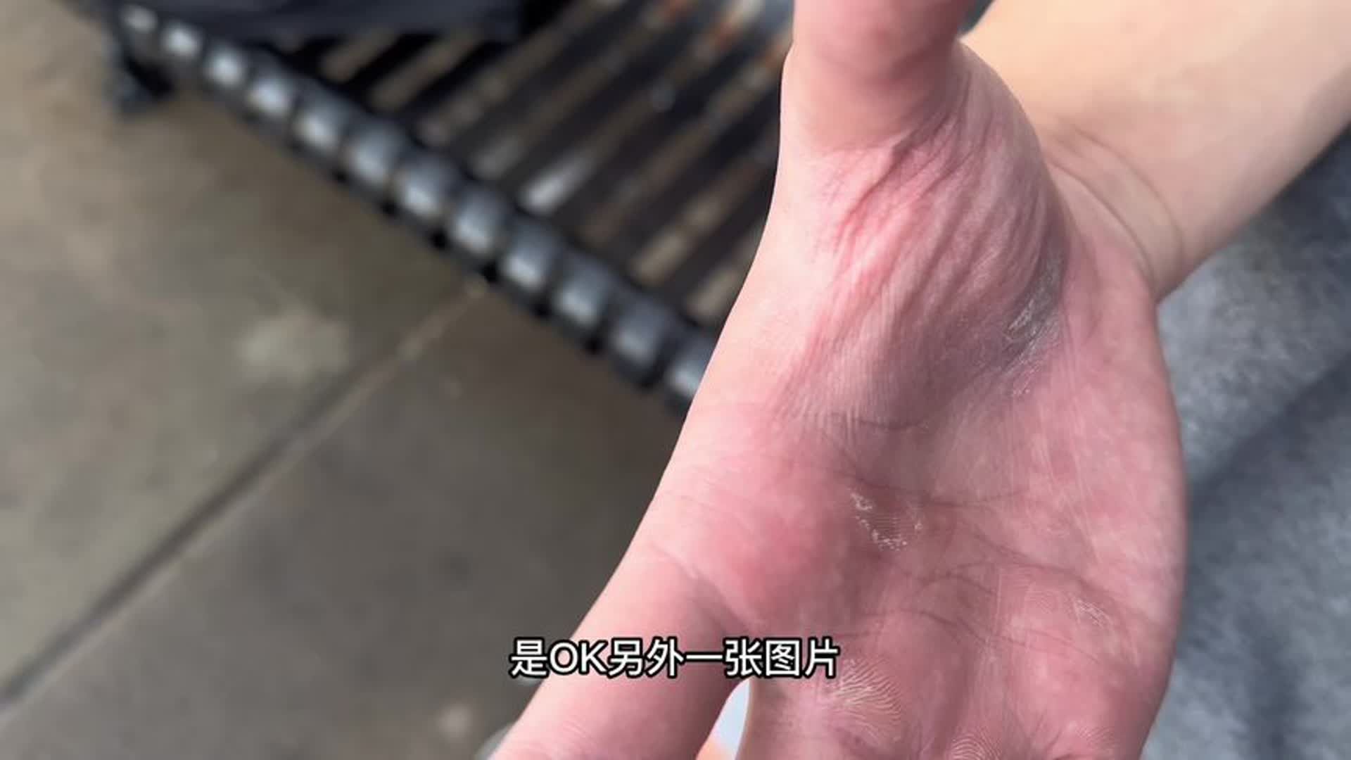 【案例分析】自身免疫系统的问题可以参考…