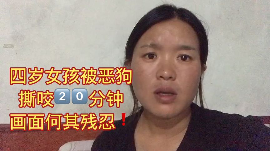 4岁女孩被恶狗撕咬20分钟,何其残忍!