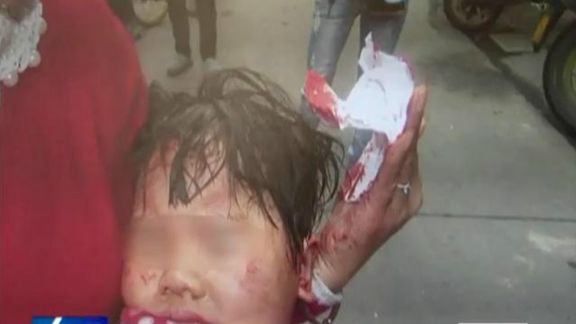 寻凶!天降砖块砸中两岁女童,警方征集破案线索