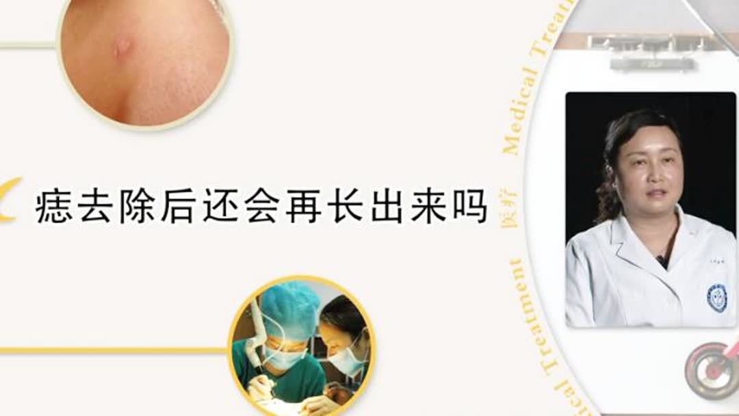 痣去除后还会再长出来吗?听听专业医生怎么说