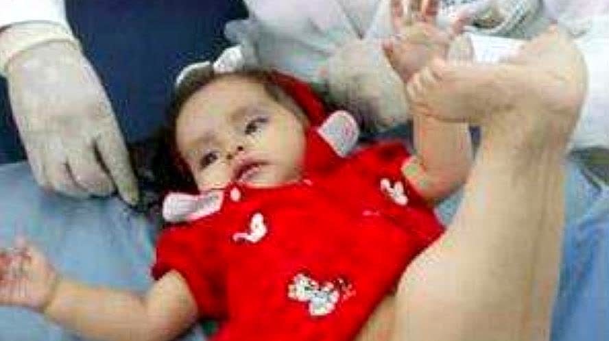 国外女子生下"美人鱼宝宝",出生时长着尾巴,医生都被...