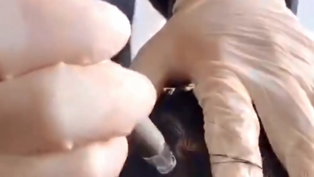 妮雀娜微针导入仪操作视频