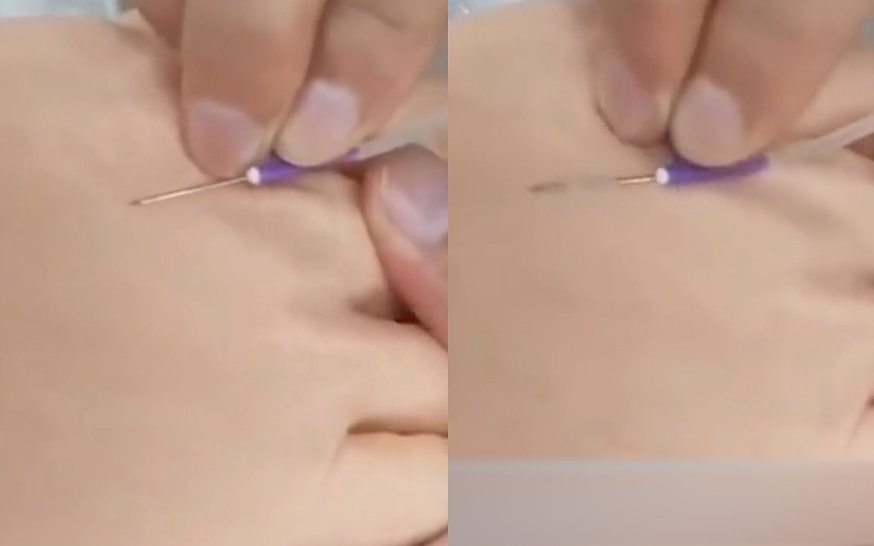 河北医学生用模型手练习扎针,一针下去手背瞬间扎穿:别毕业好嘛