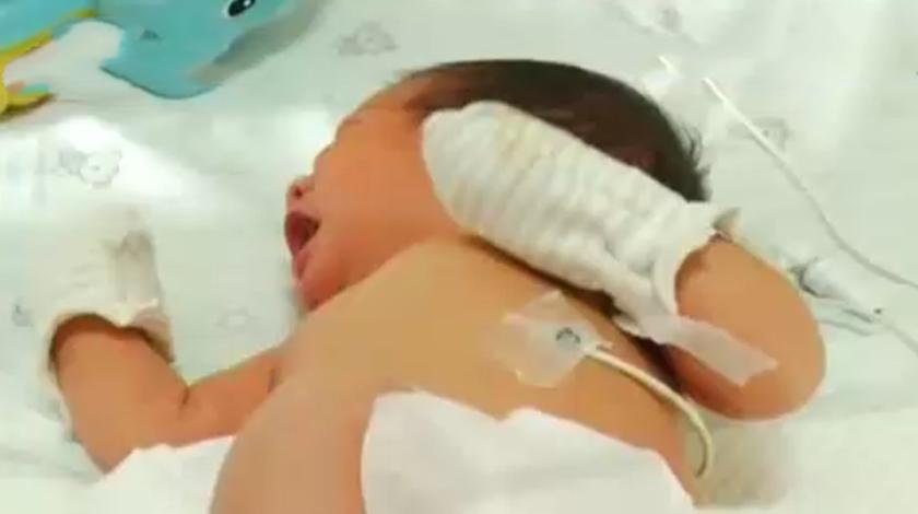 震惊!出生宝宝竟然长有“小尾巴”?医生:必须手术|最紧要健康