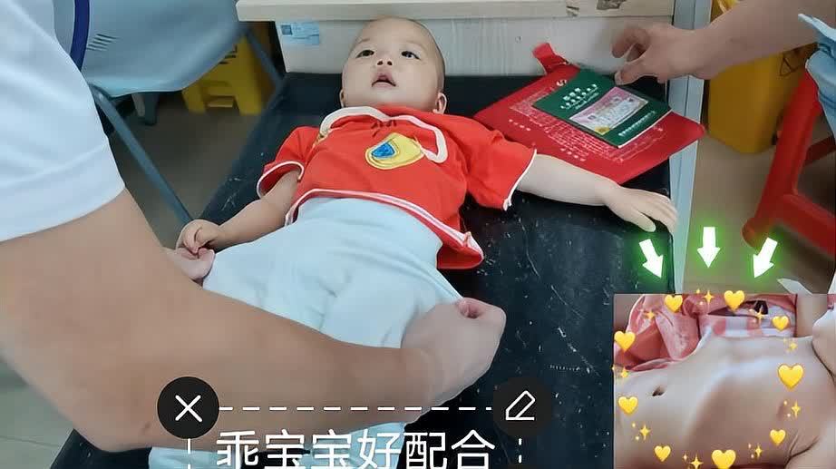 发现宝宝这样睡觉吓到当妈的了,赶紧去医院,看看医生怎么说?