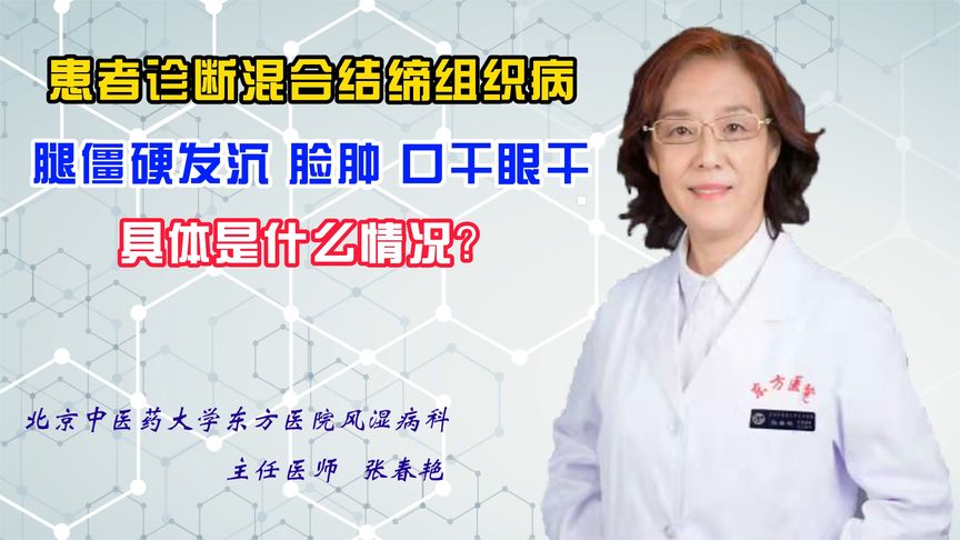 患者诊断混合结缔组织病,口干眼干是什么原因呢?