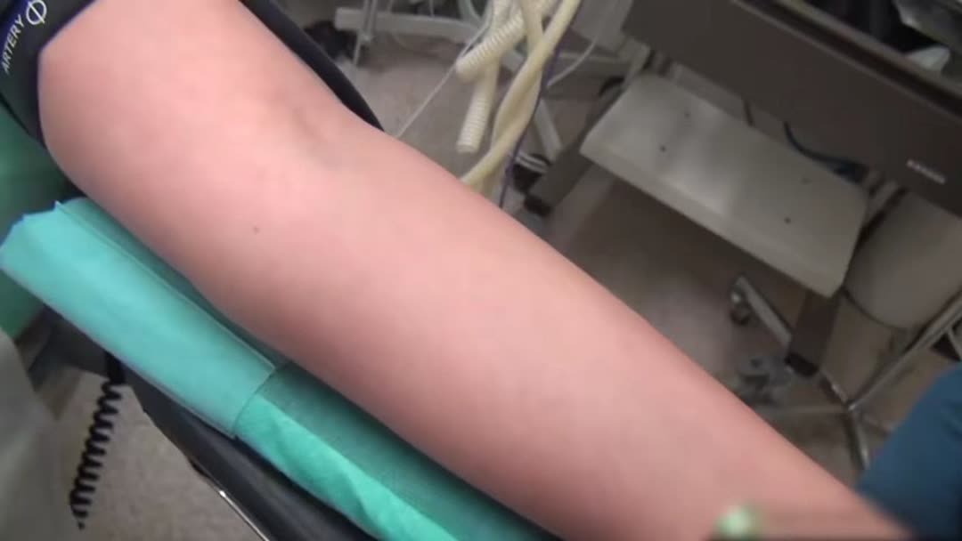 手术前麻醉操作全过程,2分钟快速了解。