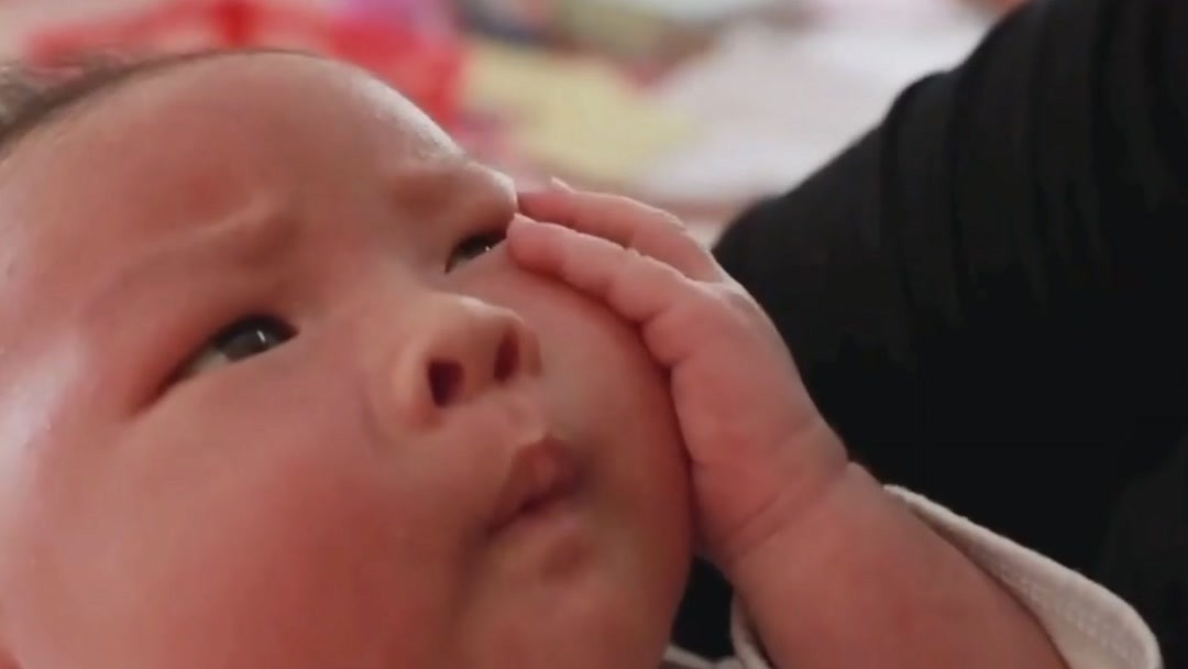 胎儿脐带扭转37圈 像麻花一样 手术仅用9分钟胎儿就被取出