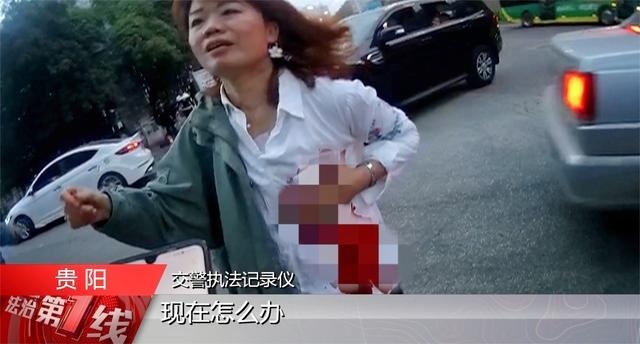 女子做完手术,马路上伤口突然大出血,浸透上衣,紧急求助交警
