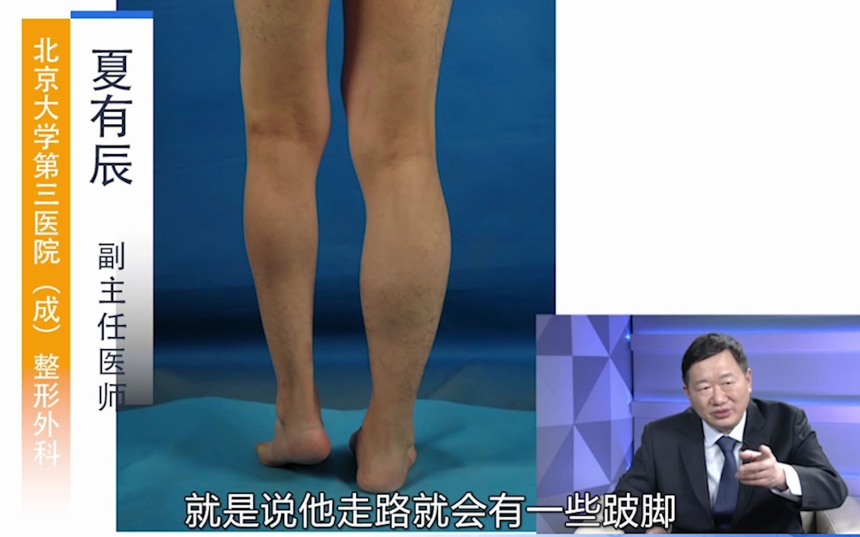 血管畸形硬化治疗后,不能忽视康复治疗!